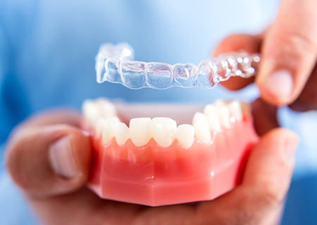 Invisalign® Info in Charlotte NC | Dentistry of Uptown Charlotte